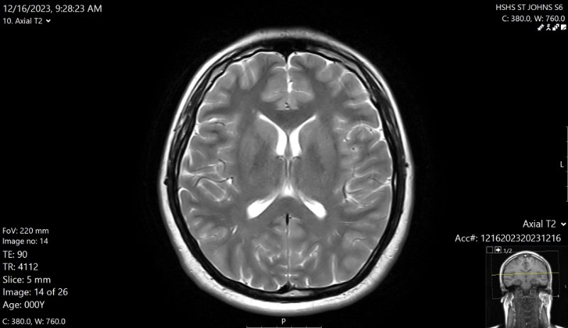 Open MRI Images
