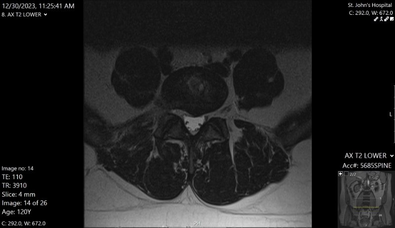 Open MRI Images