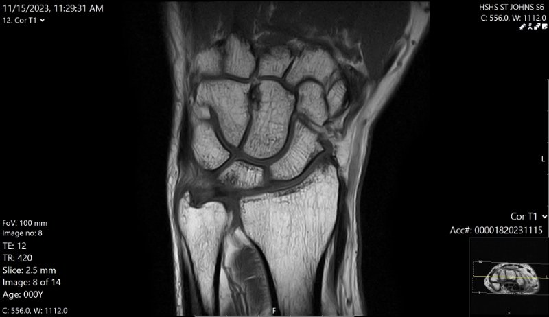 Open Mri Images