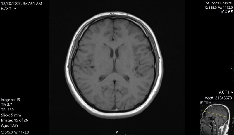 Open MRI Images