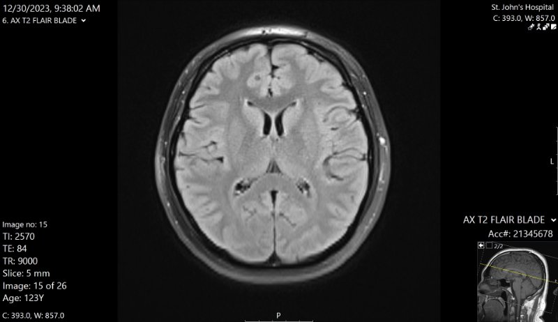 Open Mri Images