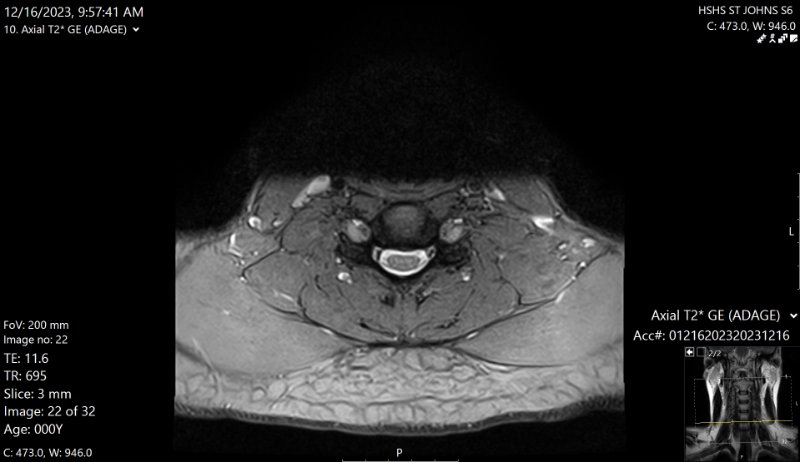 Open MRI Images