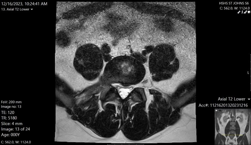 Open MRI Images