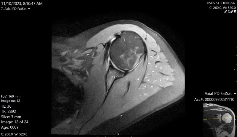 Open Mri Images