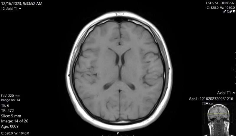 Open MRI Images