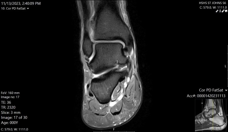 Open Mri Images