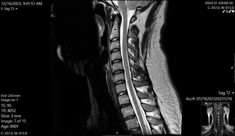 Open Mri Images