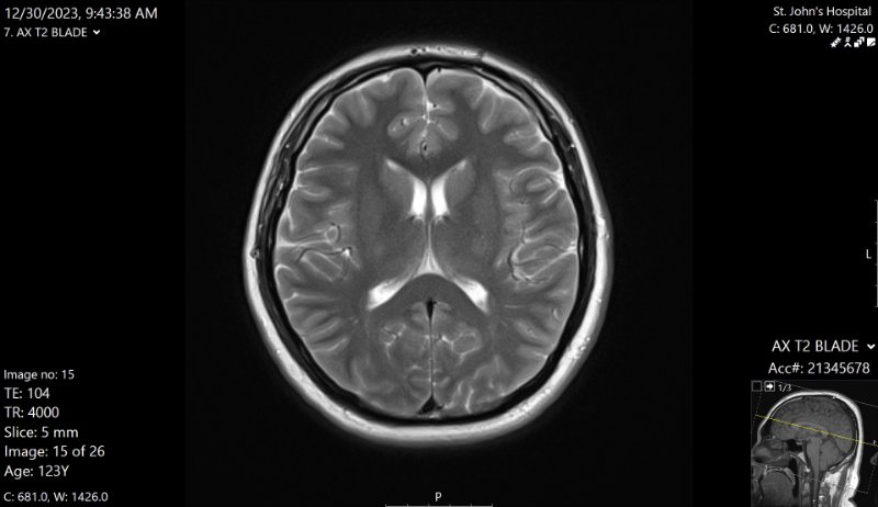 Open MRI Images