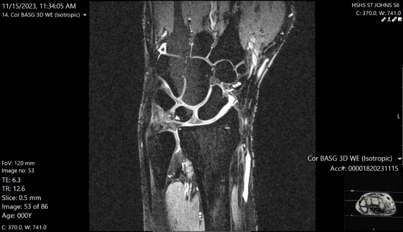 Open Mri Images