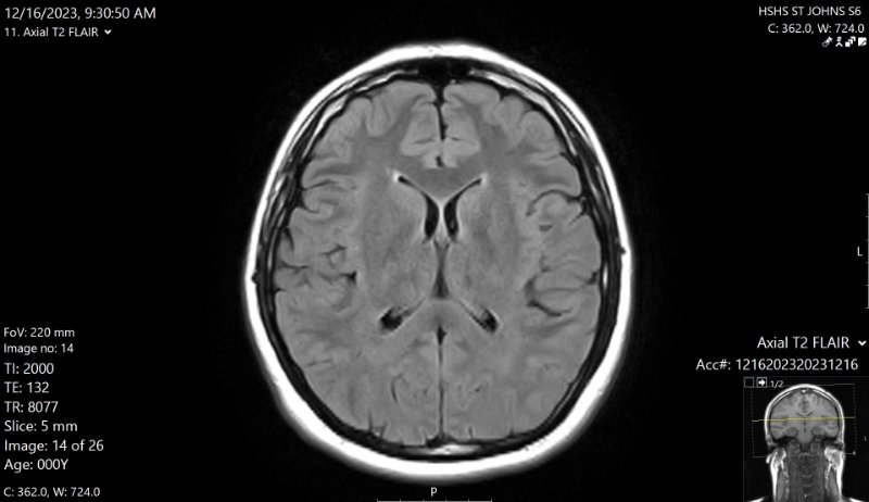 Open MRI Images